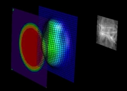 lasik advanced custom wavefront