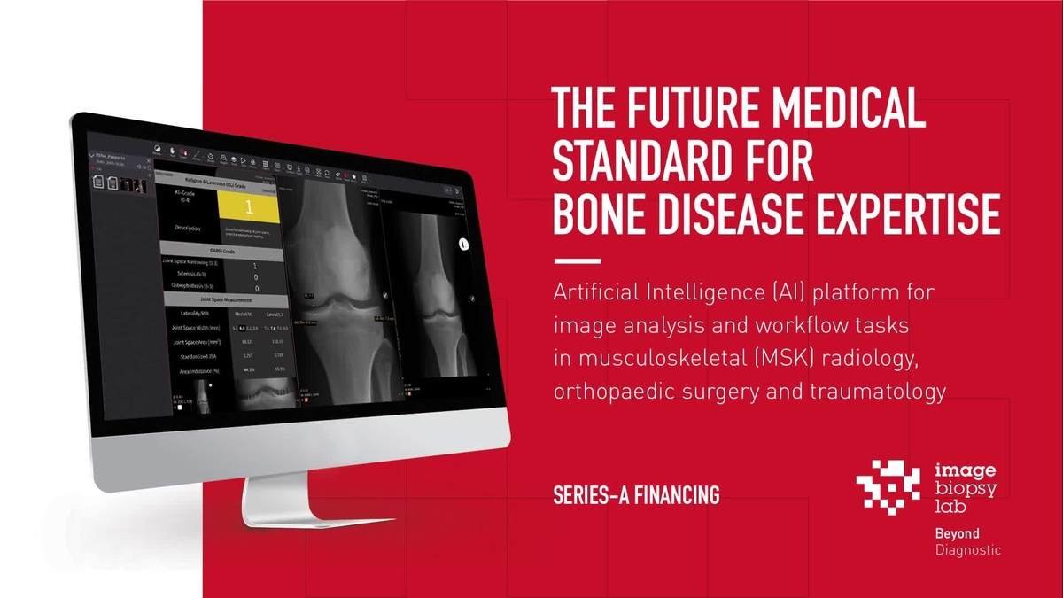 Ai Based Prediction In Bone Diseases Gtc Digital October 2020 Nvidia On Demand