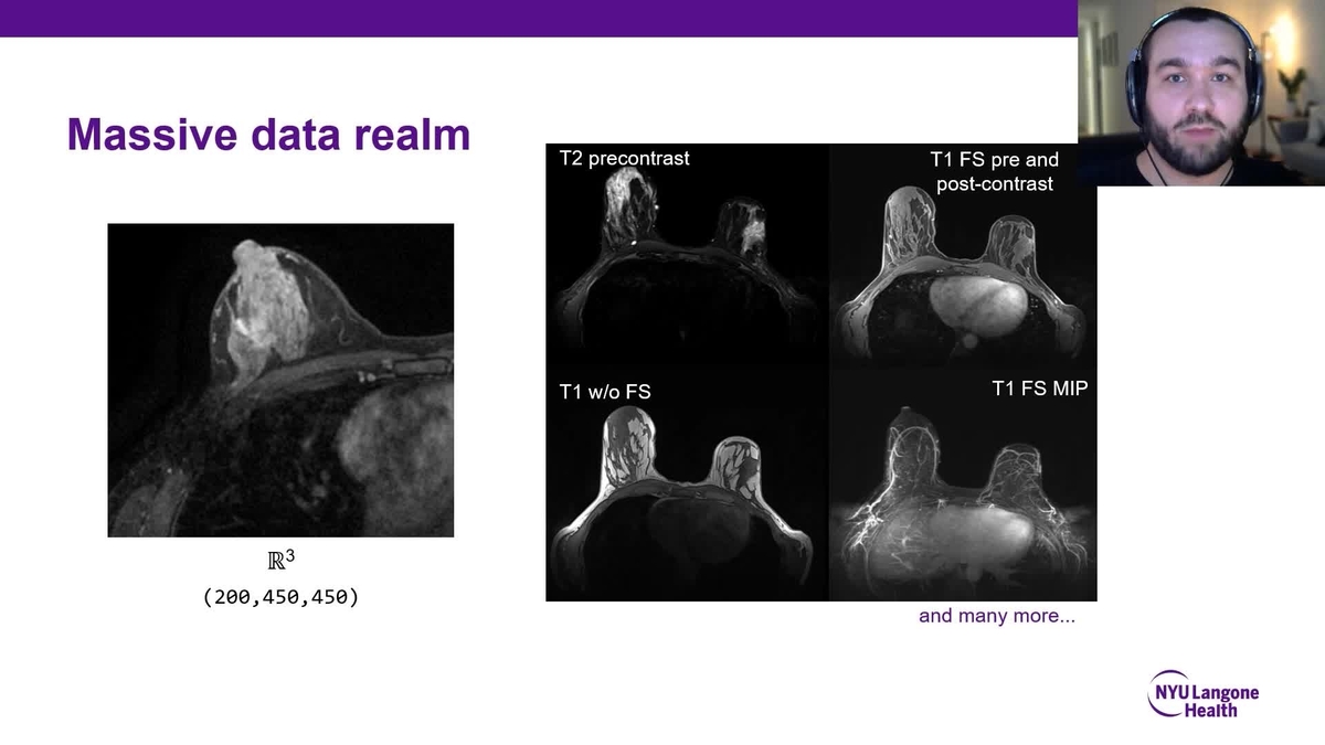 Classification of Breast MRI Volumetric Images with Temporal Components ...