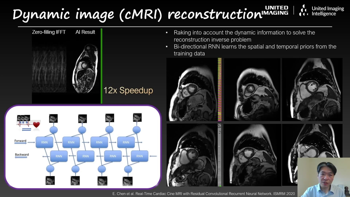 AI in Medical Imaging and Smart Medical Devices | GTC Digital April ...