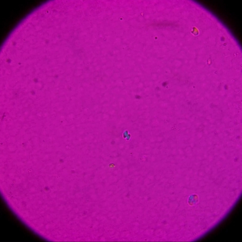 Recycling Plastic Under the Microscope | NIST