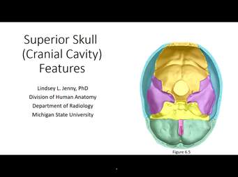Cranial Cavity Diagram